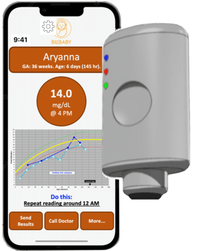 BiliBaby | Newborn Jaundice Monitoring